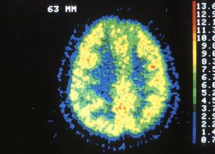 Patient Basics: Positron Emission Tomography (PET Scan) | 2 Minute Medicine