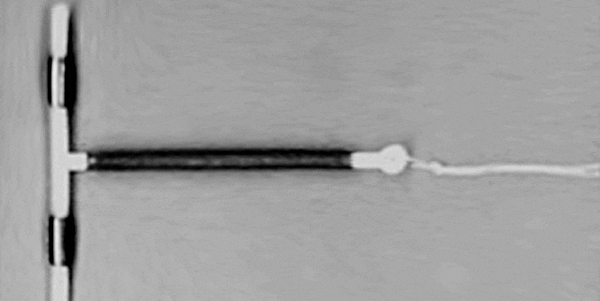 Immediate postpartum intrauterine device insertion associated with ...