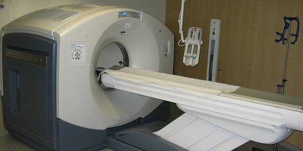Alzheimer disease diagnoses aided by amyloid positive PET scans | 2 ...