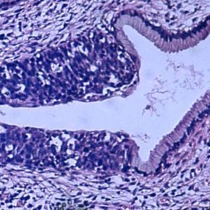 Iscalimab shows dose-dependent improvement among patients with active ...