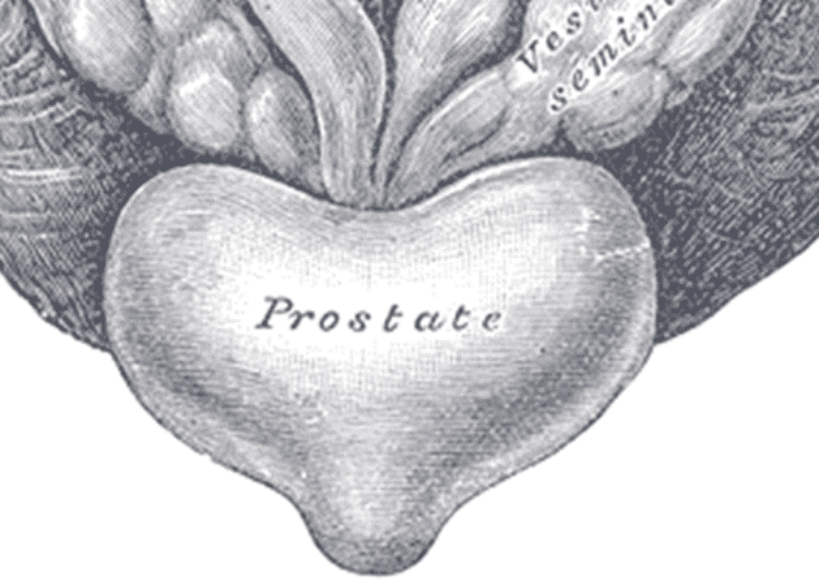 Positive prostate MRI and targeted biopsy reduce the detection of ...