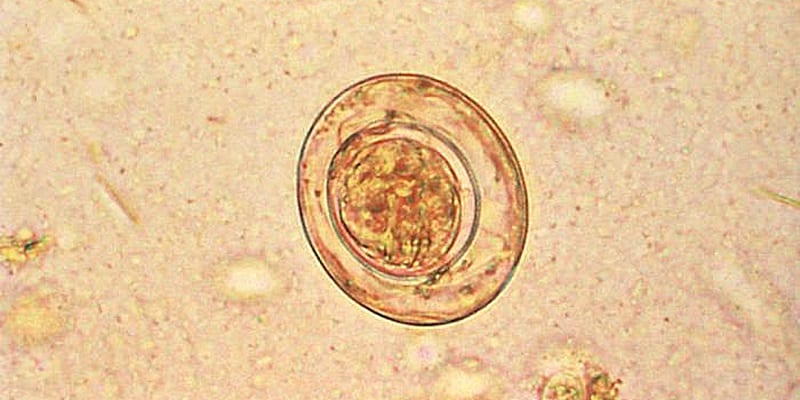 Neoplastic tapeworm cells may invade human tissue in immunocompromised ...