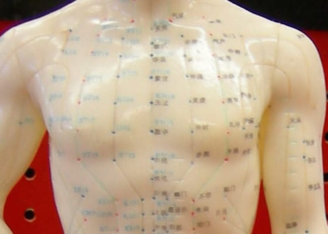 Patient Basics: Acupuncture | 2 Minute Medicine