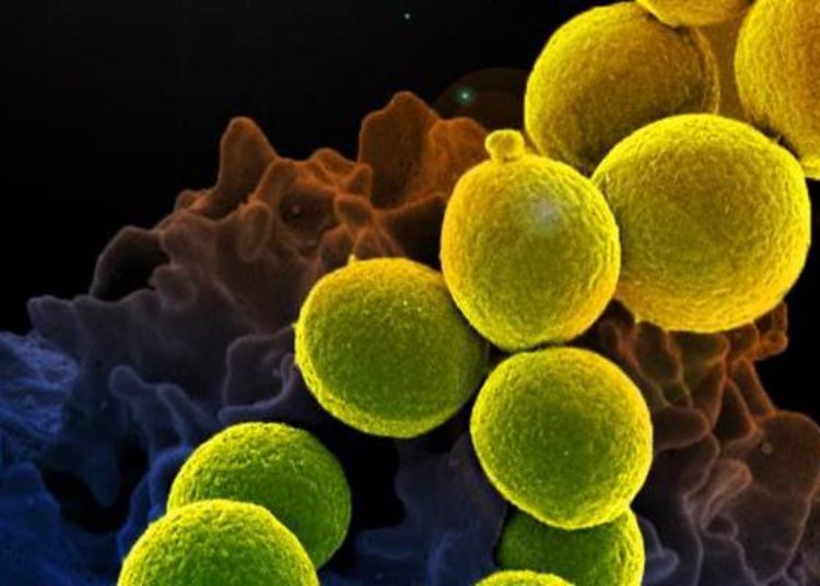 Household MRSA contamination associated with recurrent infection | 2 ...