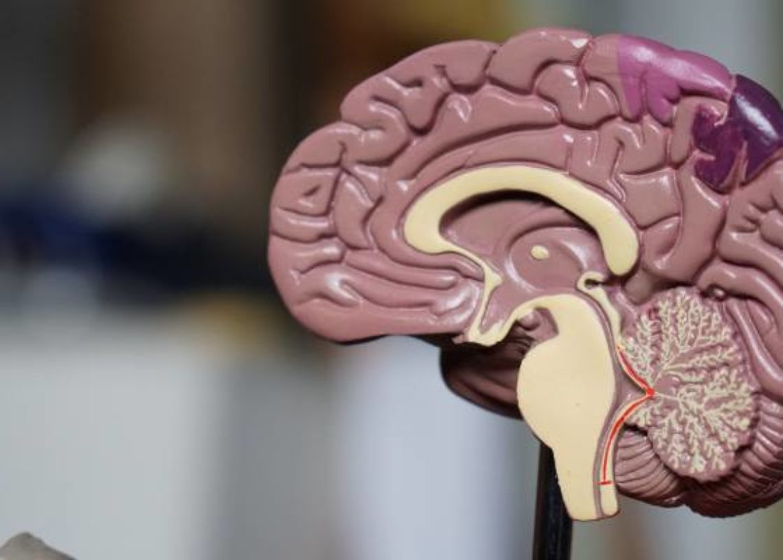 The EXTEND trial: neurological deficits decreased with thrombolysis up ...