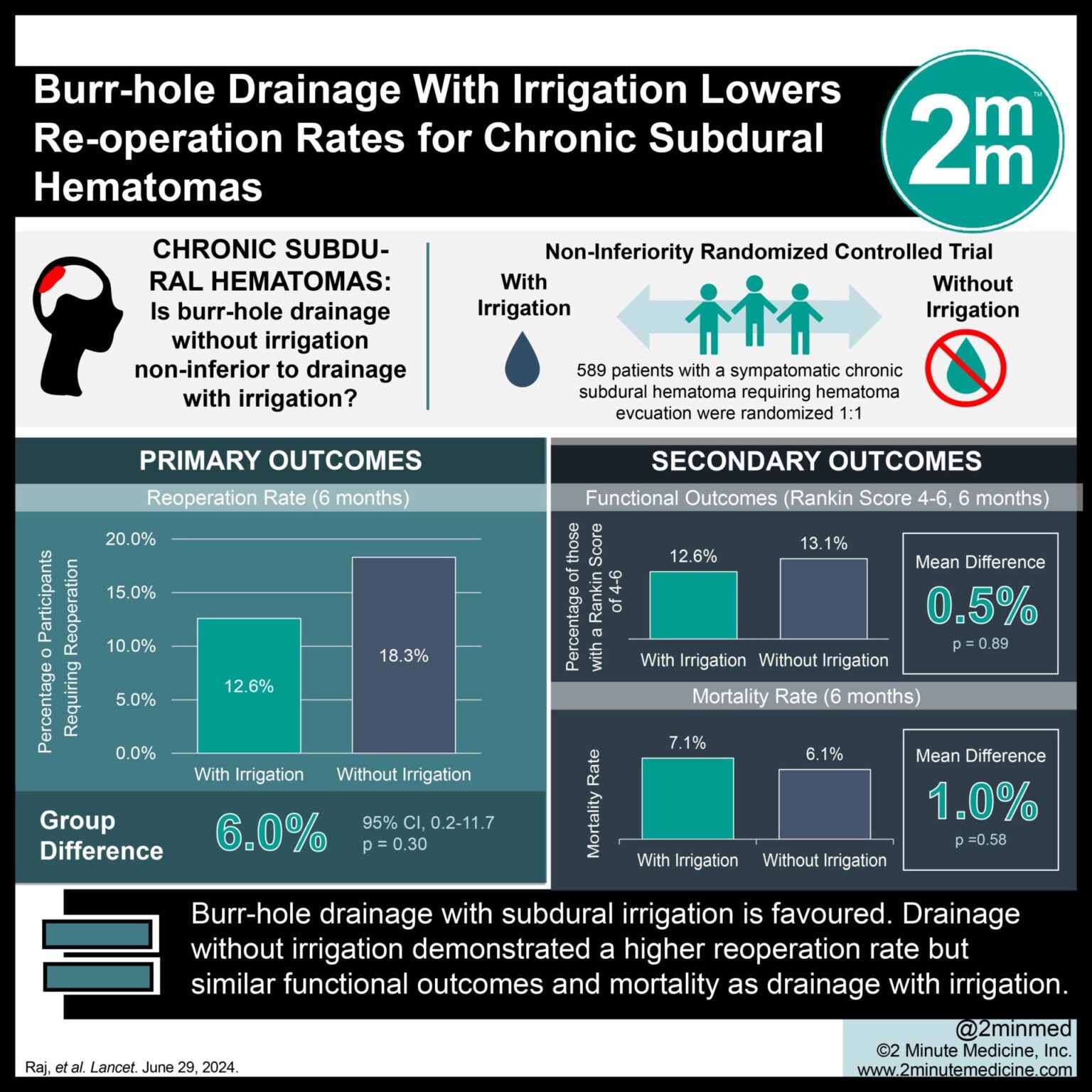 #VisualAbstract: Burr-hole Drainage With Irrigation Lowers Re-Operation ...